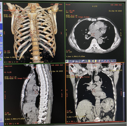 【影像科普】CT检查中的三维重建是什么检查？ - 犍为县中医医院