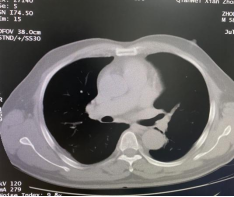 【影像科普】CT检查中的三维重建是什么检查？ - 犍为县中医医院