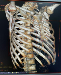 【影像科普】CT检查中的三维重建是什么检查？ - 犍为县中医医院